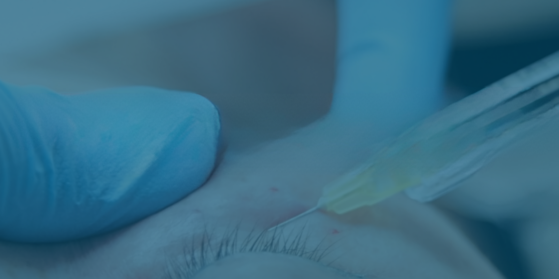 Buy Exosomes Online – Filler Deliver